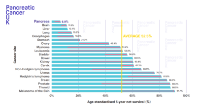Pancreatic cancer statistics - Pancreatic Cancer UK